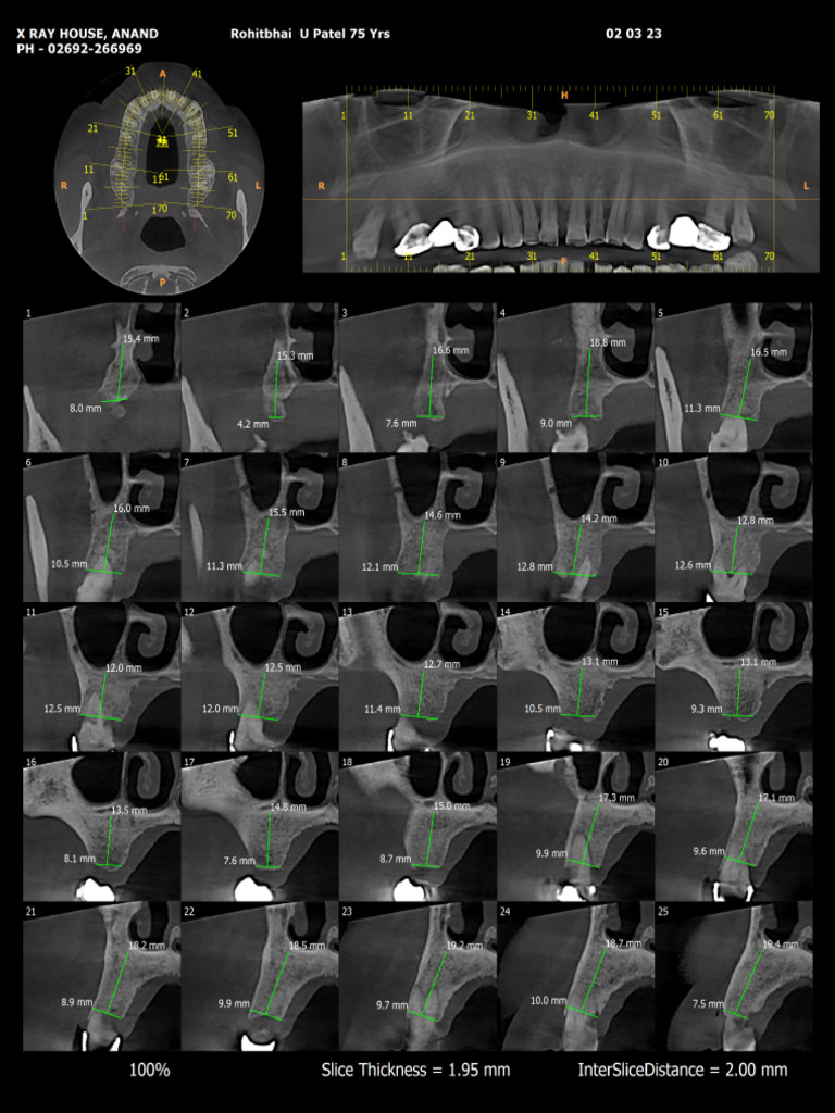 Max CBCT | PDF