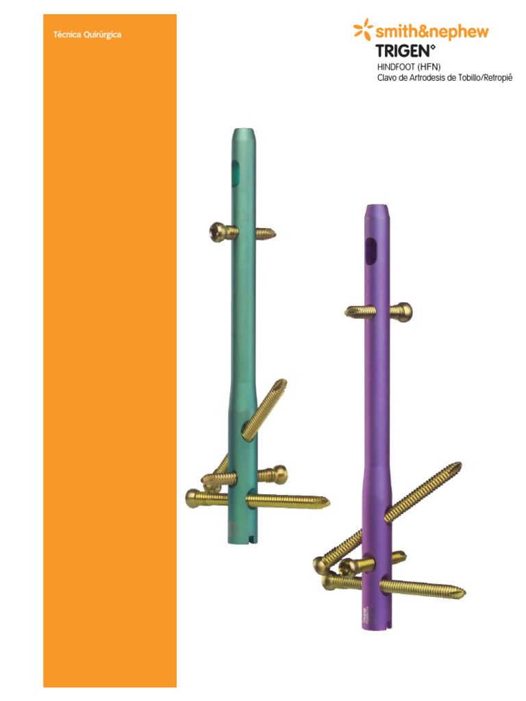 Trigen Clavo Artrodesis Retrogrado Tobillo Smithnephew | PDF | Tornillo ...