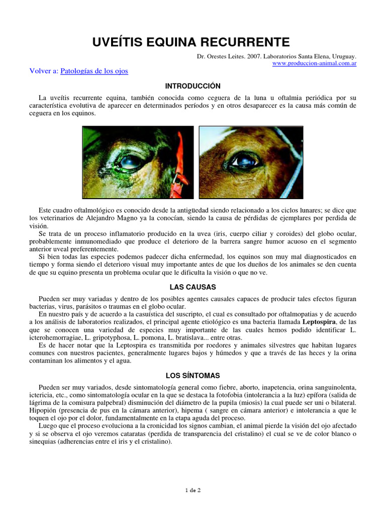 07 Uveitis | PDF