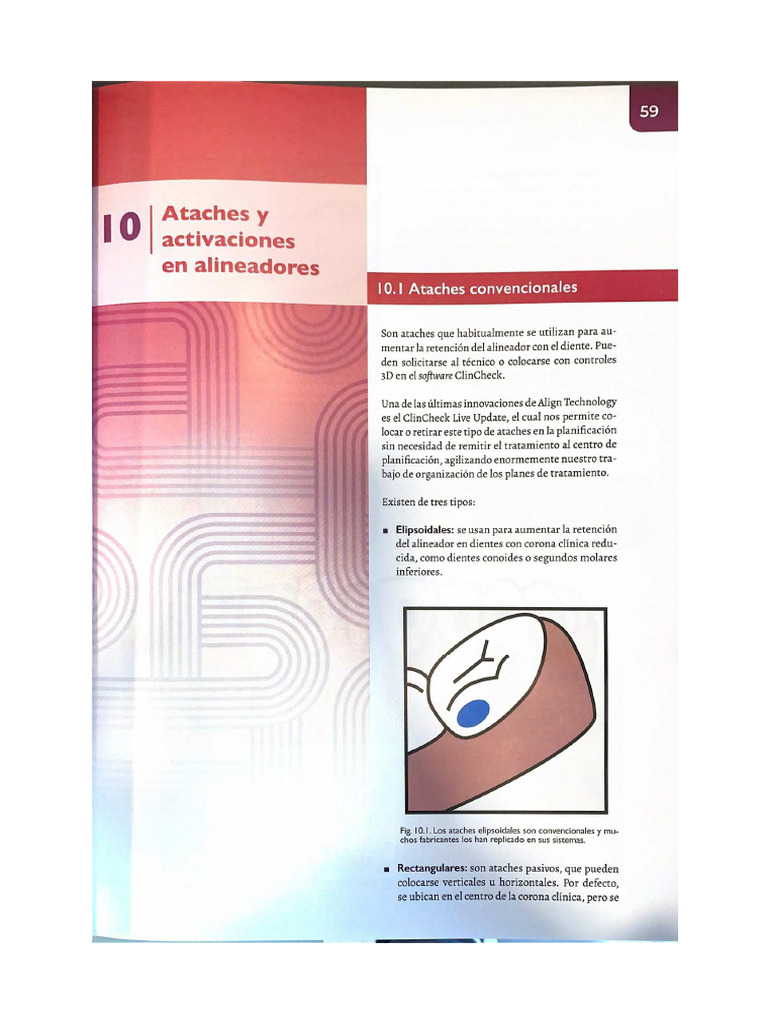 10-Ataches y Activacion de Alineadores | PDF