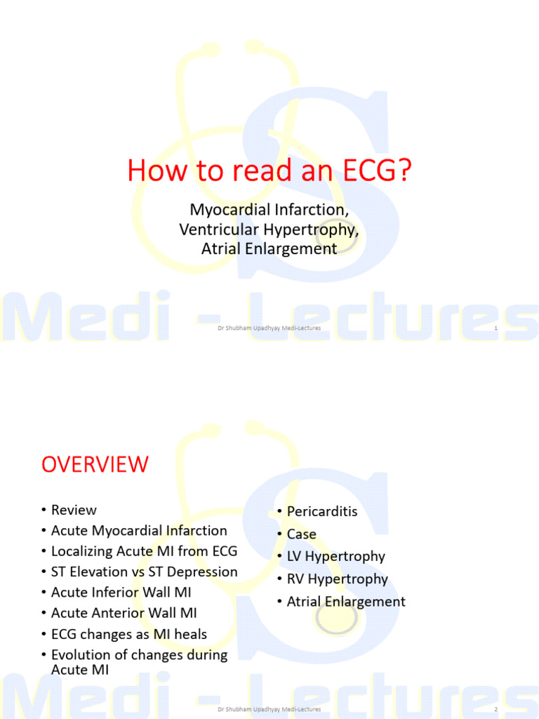 Ecg 2 | PDF | Electrocardiography | Myocardial Infarction