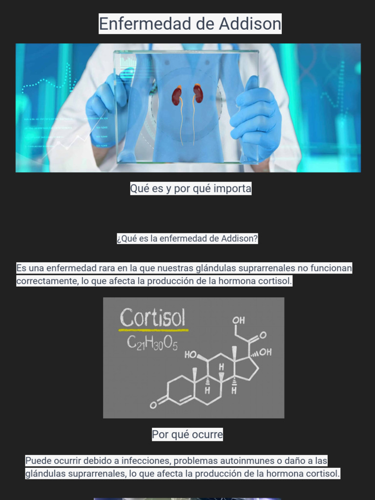 Addison Enfermedad | PDF | Glándula suprarrenal | Cortisol