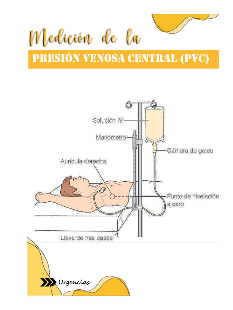 Presión Venosa Central (PVC) : Urgencias | PDF | Vena | Corazón