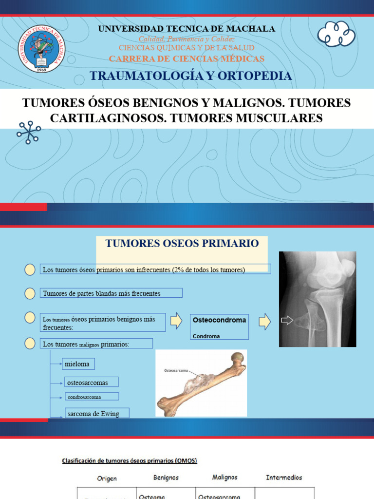 Tumores Oseos Beningnos en Traumatologia | PDF | Cáncer | Hueso