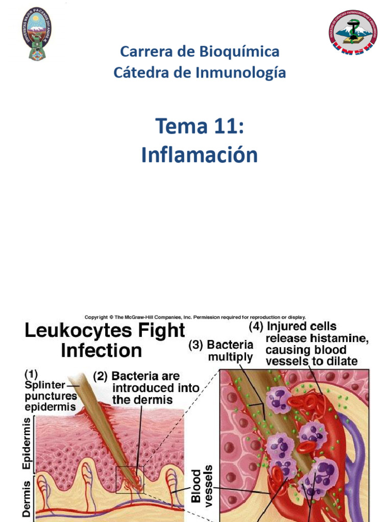 11 Inflamación NNP | PDF
