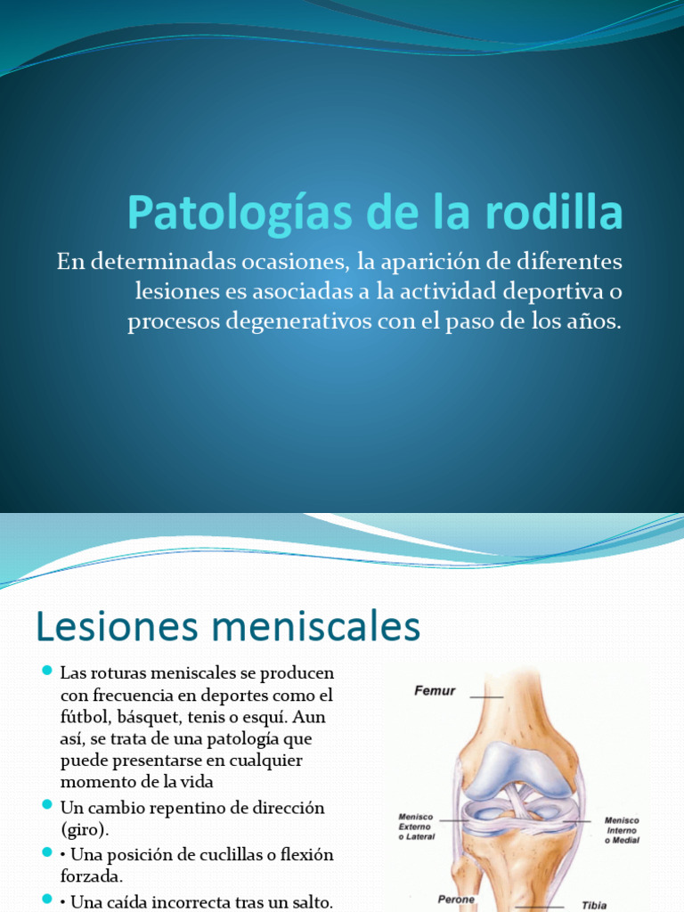 Lesiones y Patologías de la Rodilla | PDF | Rodilla | Causas de la muerte