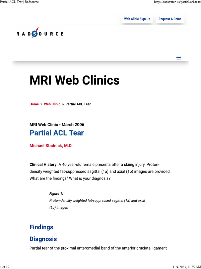 Partial ACL Tear | PDF