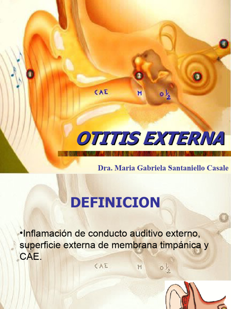 9.1 Otitis Externa | PDF | Medicina | Inmunología