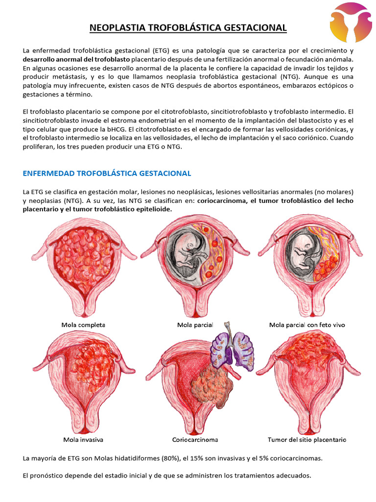 Enfermedad Trofoblástica Gestacional | PDF | Quimioterapia | El embarazo