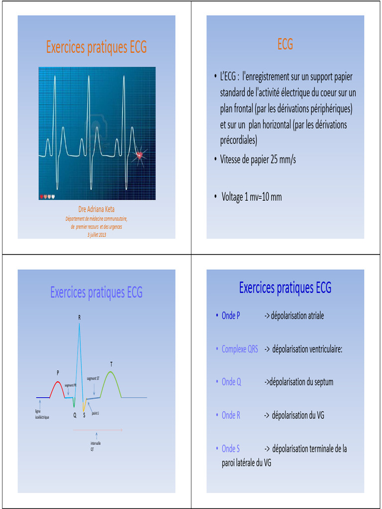 Exercices Pratiques d'Interprétation ECG | PDF | Électrocardiographie ...