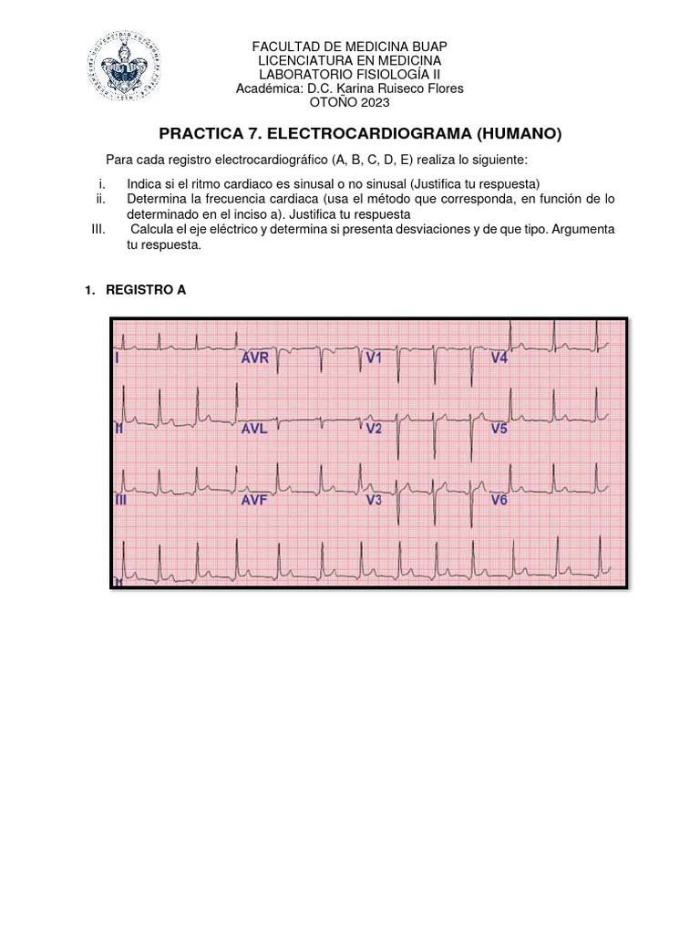 ACTIVIDAD PRACTICA 7. ELECTROCARDIOGRAMA (Evaluación EKG, otoño 2023) | PDF