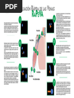 Incisión Rocky Davis | PDF | Medicina CLINICA | Anatomía