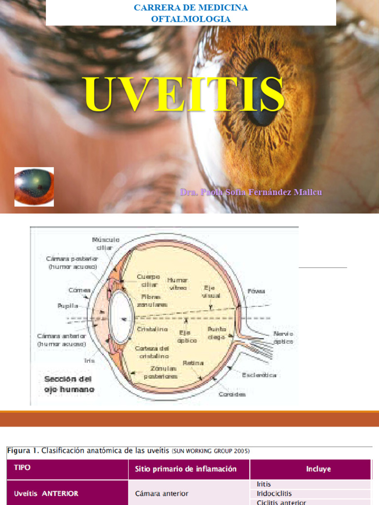 TEMA 8 UVEITIS Univalle | PDF | Inflamación | Virus