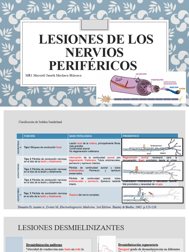 LESIONES DE LOS NERVIOS PERIFÉRICOS | PDF | Nervio | Axon