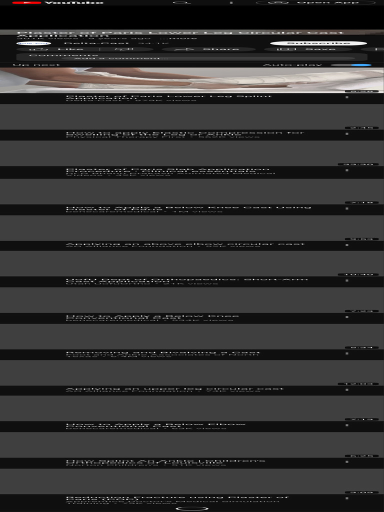 Plaster of Paris Lower Leg Circular Cast Application - YouTube ...