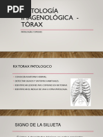 Guía de Signos Radiológicos de Tórax | PDF | Pulmón | Neumonía