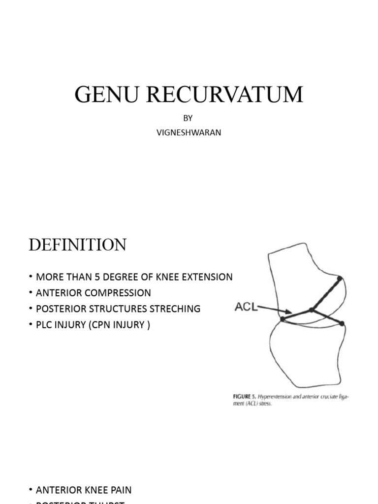 Genu Recurvatum | PDF | Human Anatomy | Joints