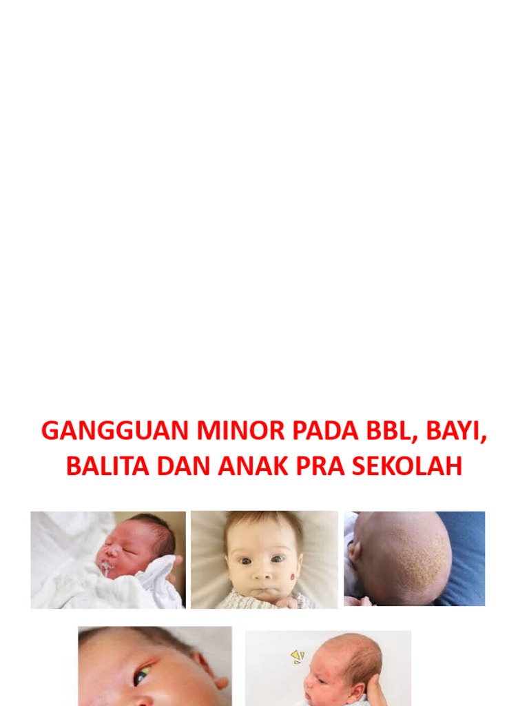 Neonatus Anpras PTM 1 2023 | PDF | Kesehatan Holistik