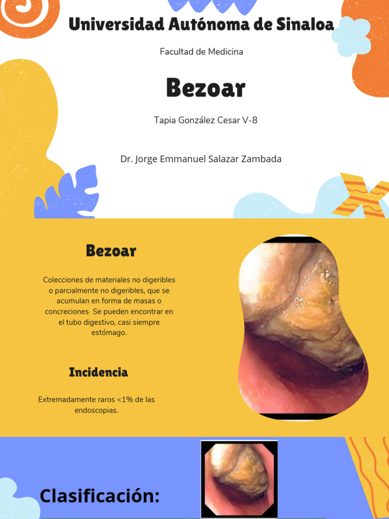 Bezoar gástrico | PDF