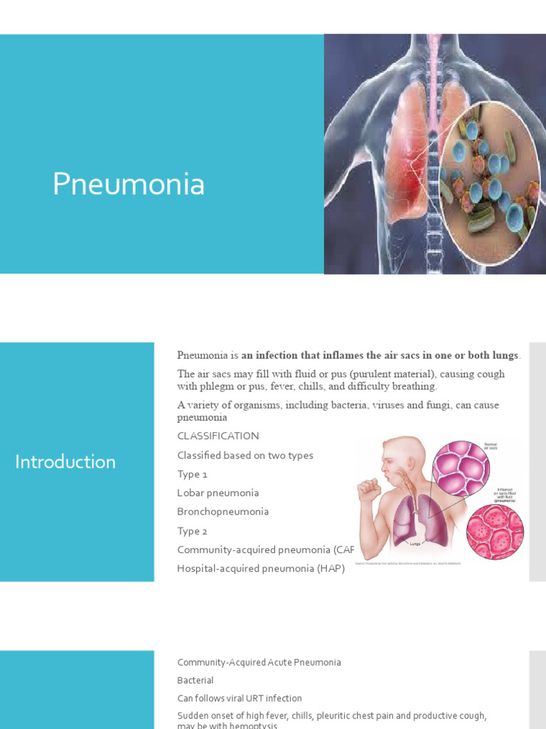 Pneumonia | PDF | Pneumonia | Medicine