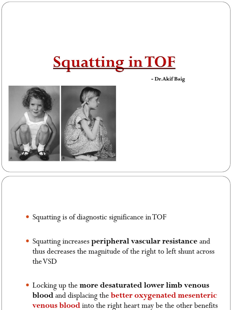 Squatting in TOF | PDF
