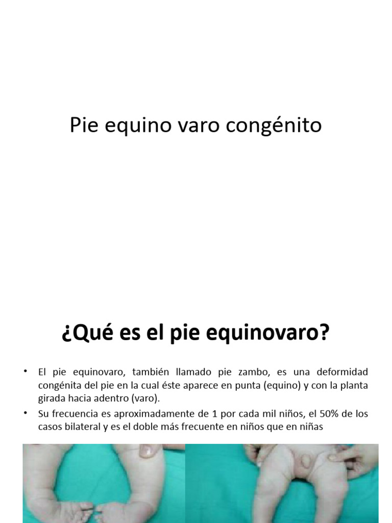 Pie Equino Varo Congénito | PDF | Pie | Especialidades Medicas