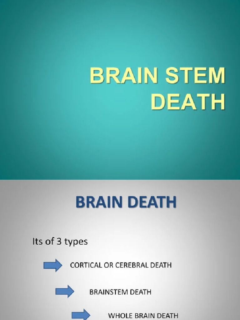 Brain Stem Death | PDF