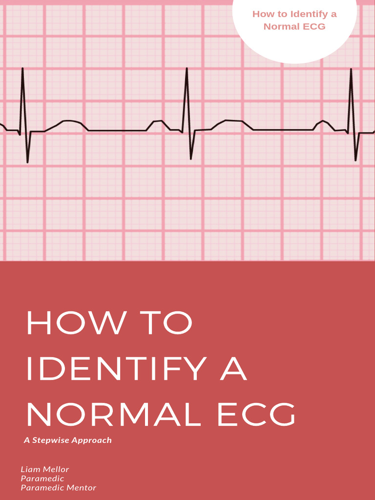 E-Book How To Identify A Normal Ecg | PDF | Electrocardiography ...