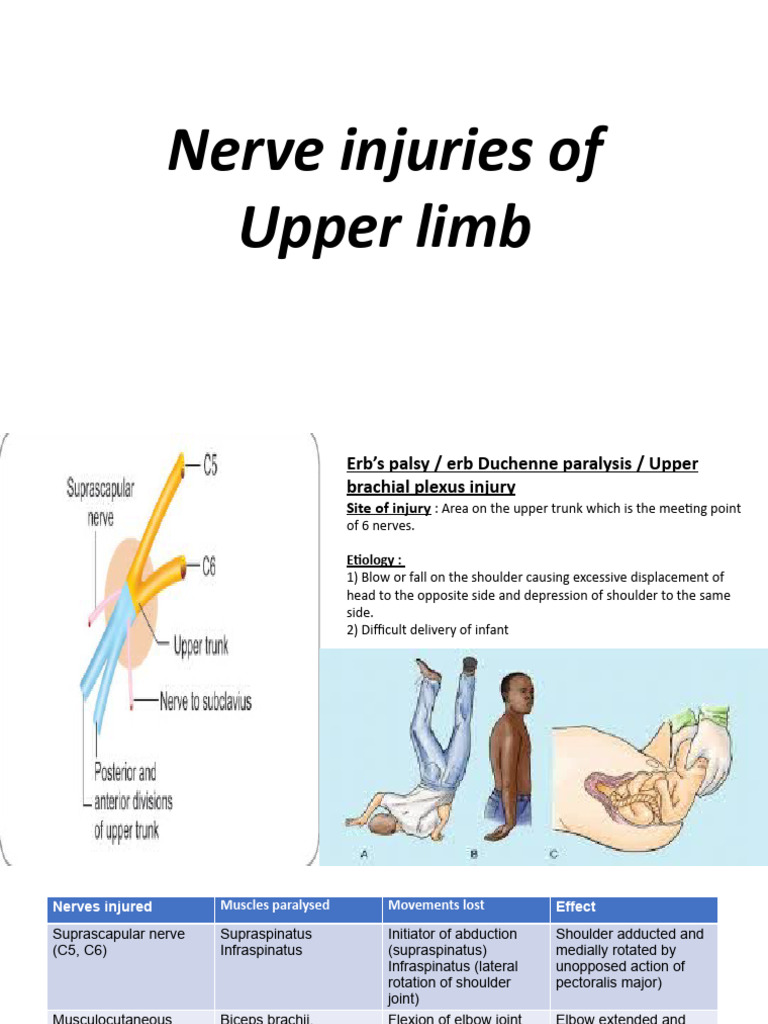 Nerve Injuries of Upper Extremity | Download Free PDF | Thumb | Hand