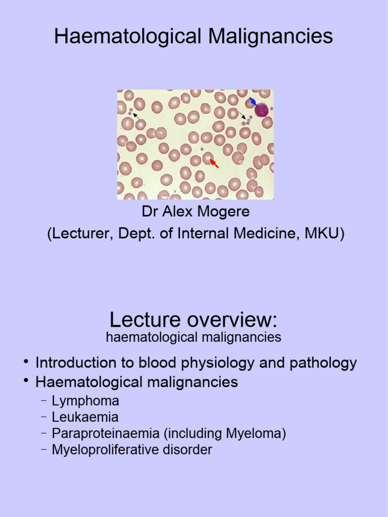 Overview of Haematological Malignancies | PDF | Leukemia ...