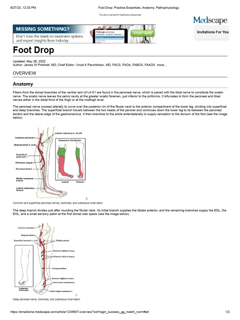 Foot Drop - Practice Essentials, Anatomy Part | PDF | Human Leg ...