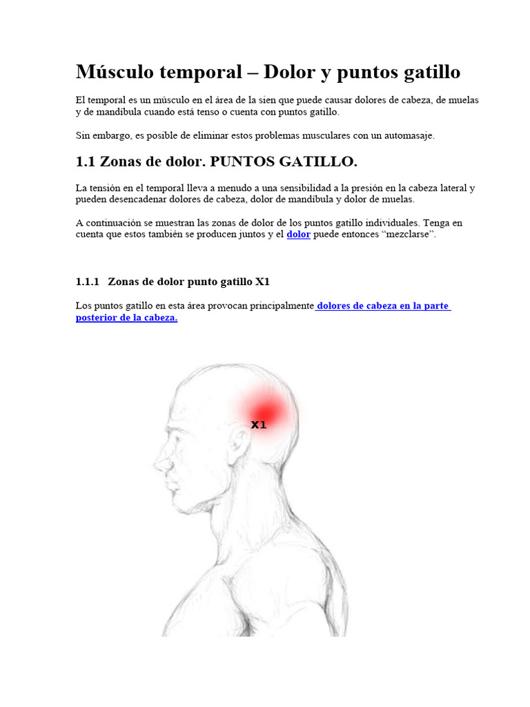 PUNTOS GATILLO ZONA TEMPORAL | PDF | Punto gatillo miofascial | Dolor