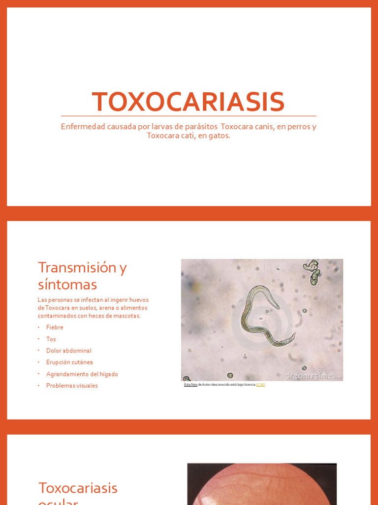 Toxocariasis | PDF