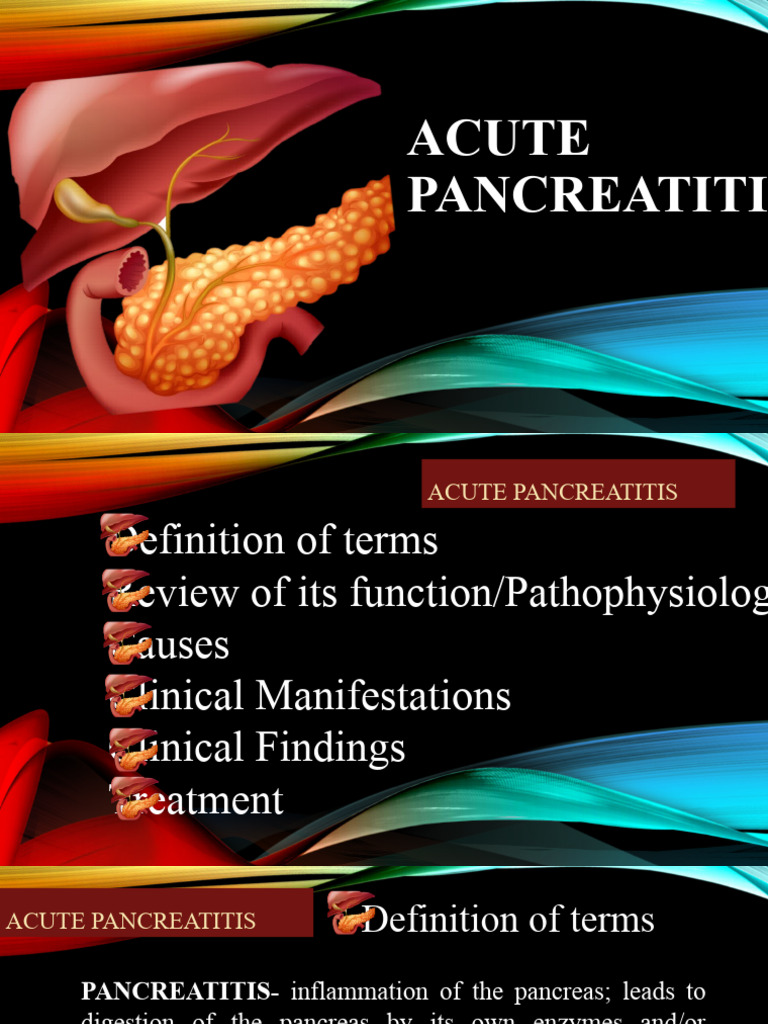 Acute Pancreatitis | PDF | Pancreas | Gastroenterology