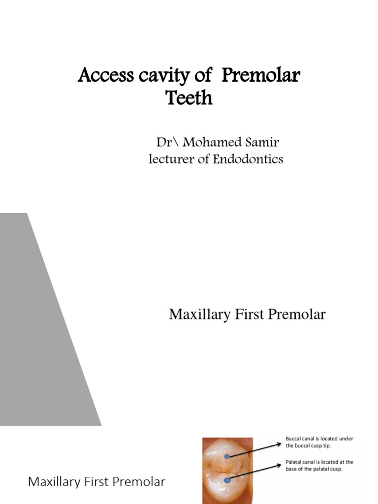 6 - Access Cavity of Premolars 2022 | PDF | Tooth | Dentistry Branches