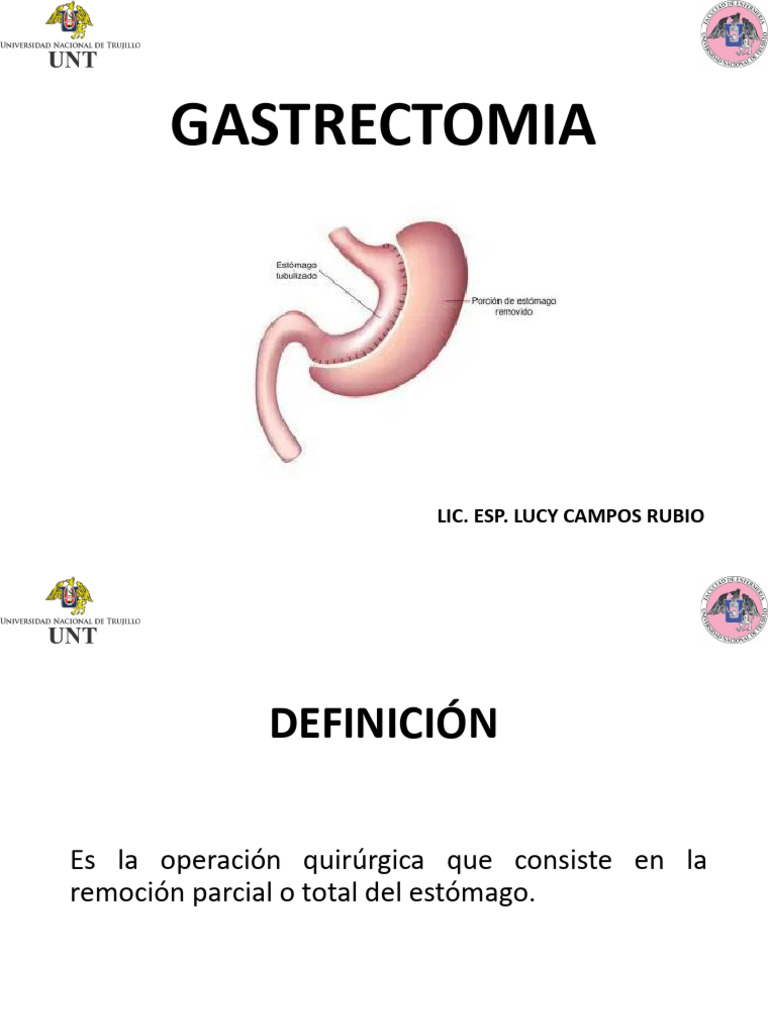 Semana 03 - Gastrectomia | Descargar gratis PDF | Estómago | Cirugía ...