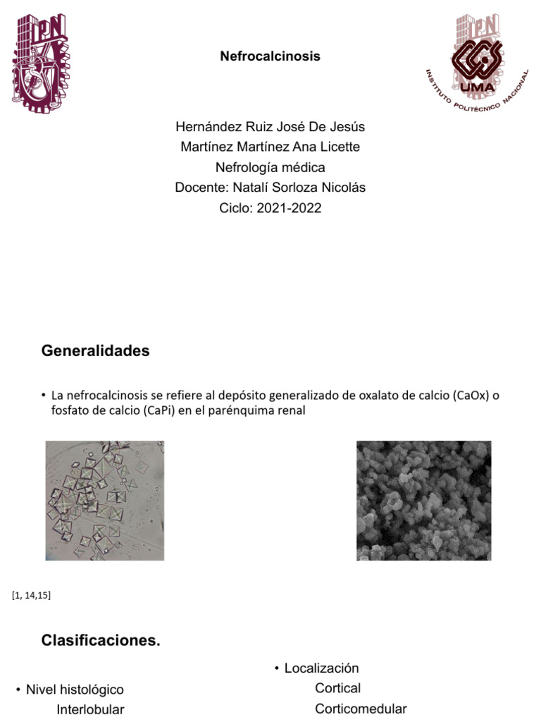 Nefrocalcinosis: Causas y Clasificación | PDF | Urología | Riñón