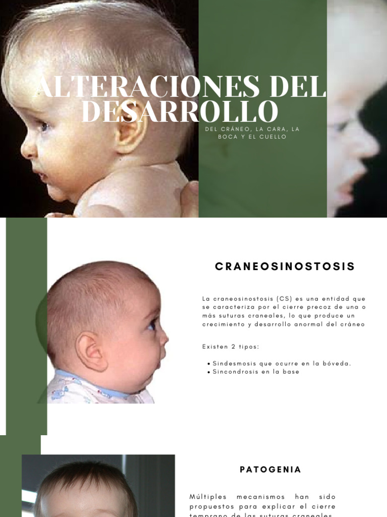 Alteraciones del desarrollo del cráneo, la cara, la boca y el cuello ...