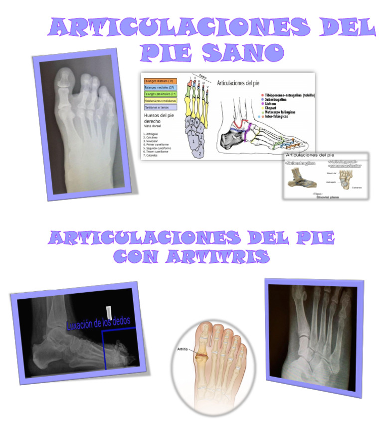 Articulaciones Del Pie Sano | PDF