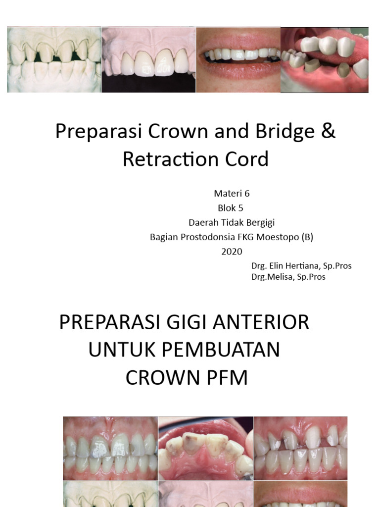 PREPARASI RETRACTION CORD 2020 | PDF