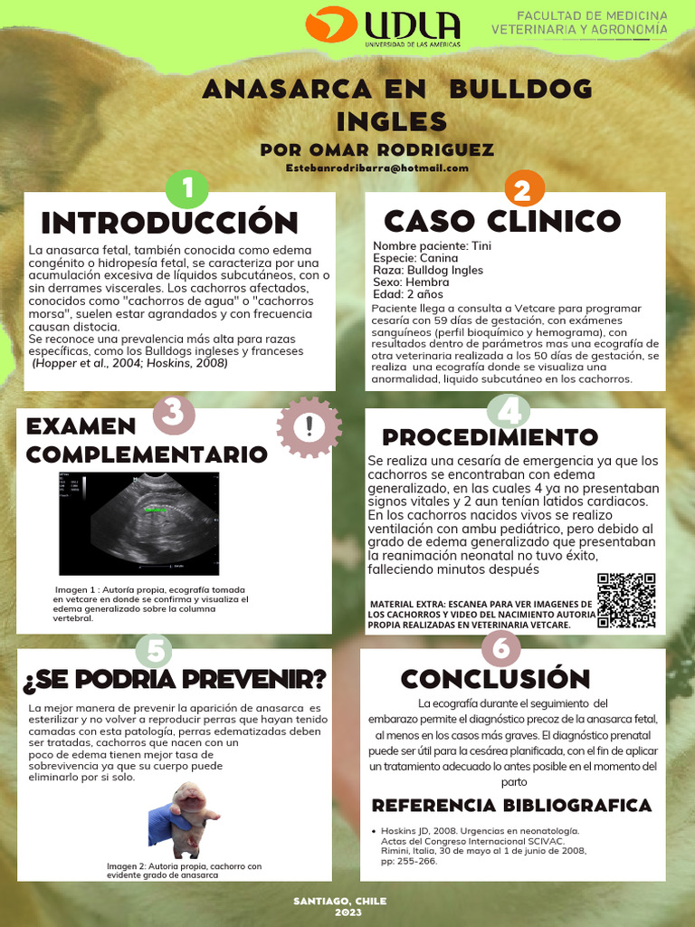 Poster Final Anasarca | PDF | Ultrasonido médico | El embarazo