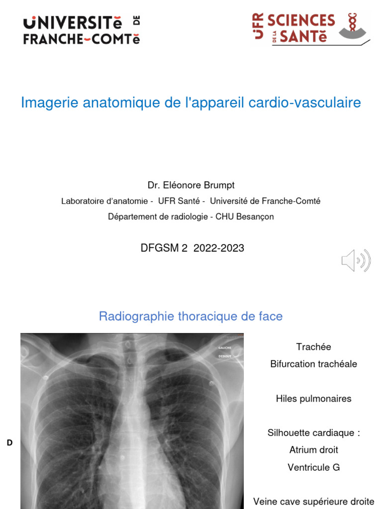 Radioanat App Cardiovascu P2 EB | PDF | Aorte | Morphologie (Biologie)