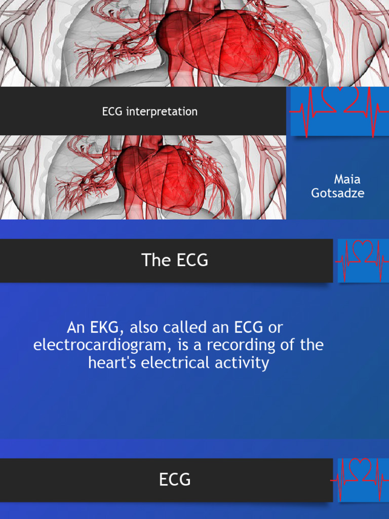 Ecg 1 | PDF | Electrocardiography | Internal Medicine
