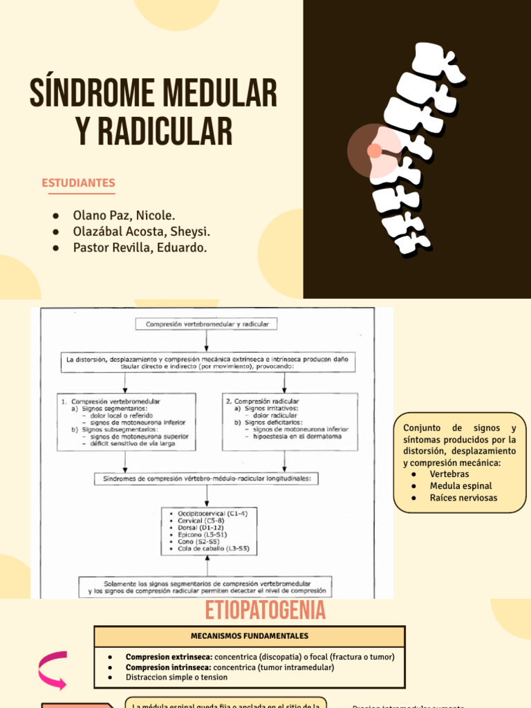Síndrome de Compresión Radicular y Vertebral | PDF | Médula espinal ...