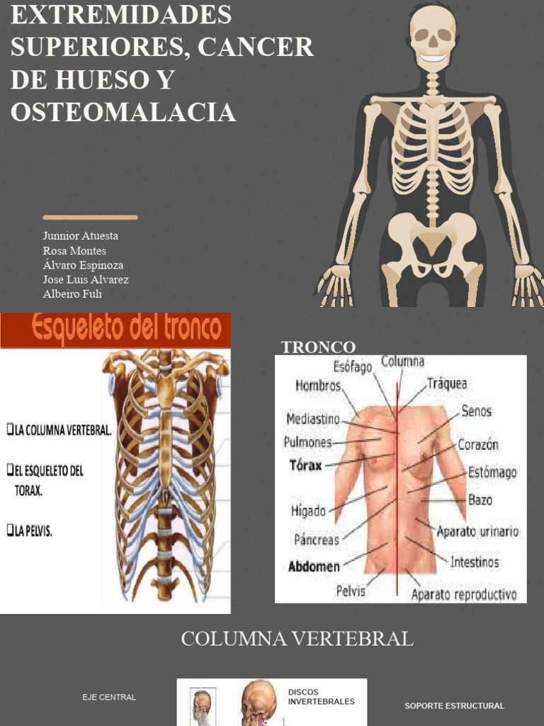 Exposicion Biologia 2do Corte 2 | PDF | Cáncer | Hueso