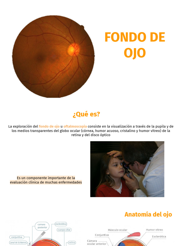 Fondo de Ojo | PDF | Ojo humano | Órganos sensoriales