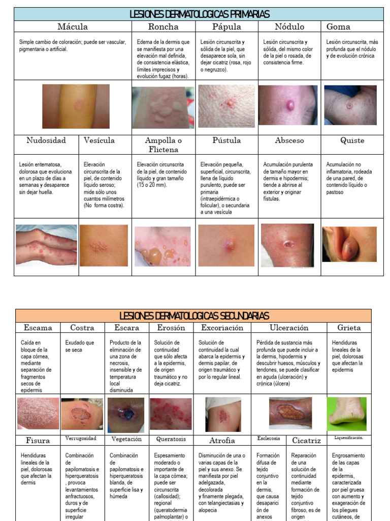 LESIONES DERMATOLOGICAS PRIMARIAS Correcto | Descargar gratis PDF | Piel | Sistema tegumentario