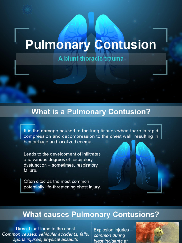 ABC - Pulmonary Contusion and Penetrating Trauma | Download Free PDF ...