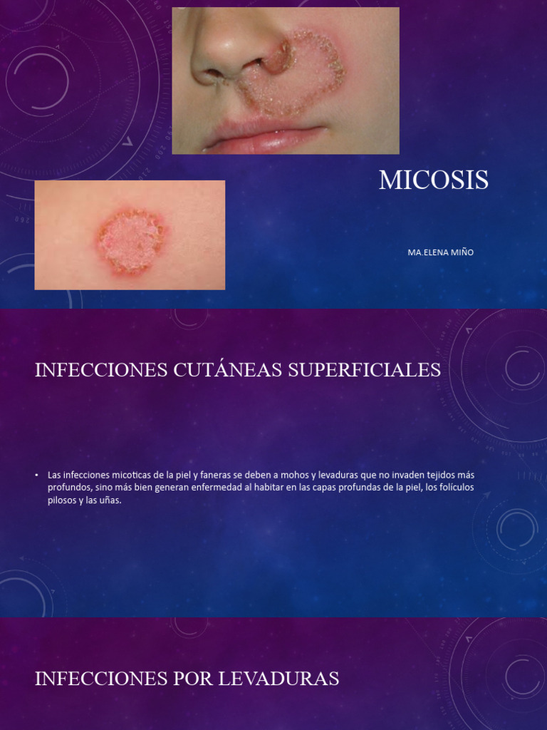 micosis | PDF | Epidemiología | Micología