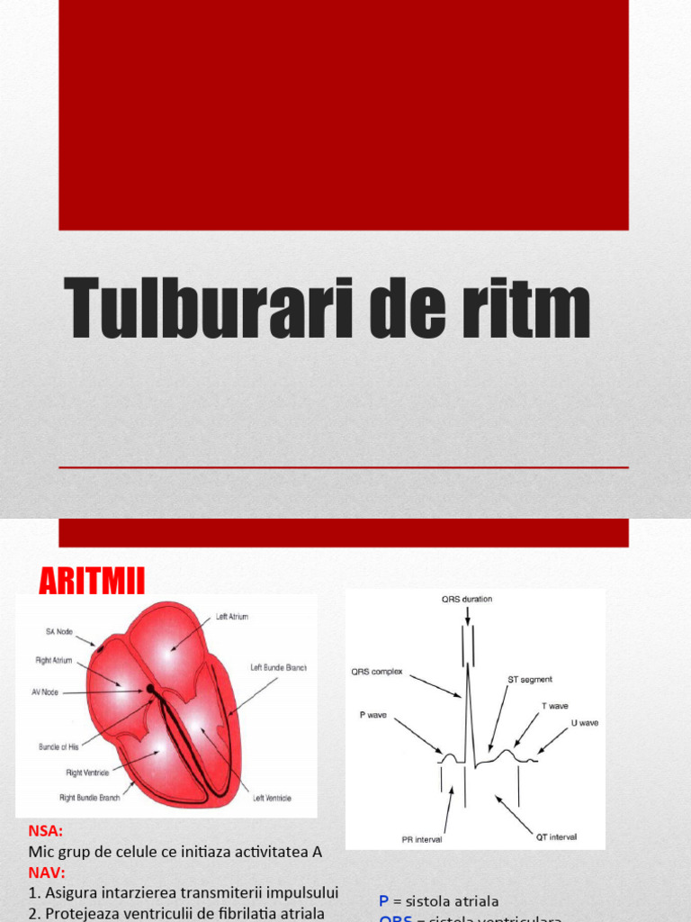 Tulburari de Ritm VI - VII | PDF